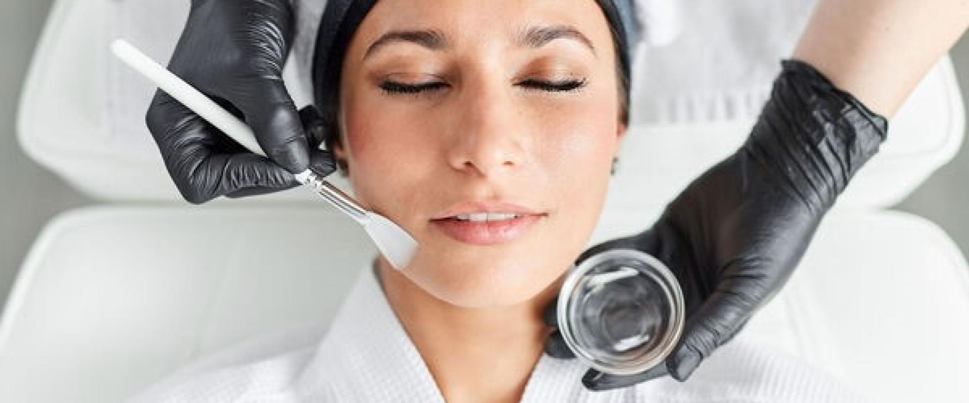 How to perform a safe and effective peel?